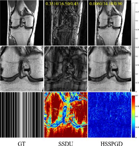 Matrix Completion Informed Deep Unfolded Equilibrium Models For Self