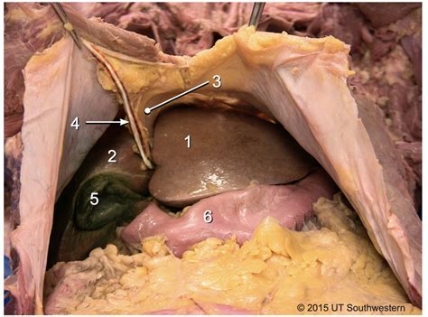 Lab 23 Falciform Ligament Diagram Quizlet