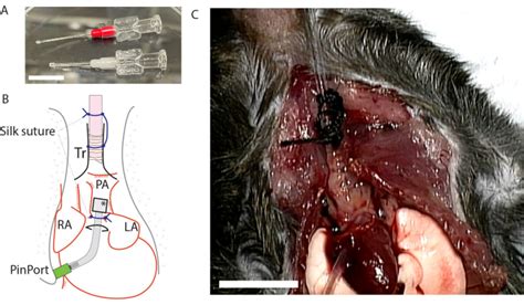 Transplantation Of Bioengineered Lung Using Decellularized Mouse Lungs And Primary Human