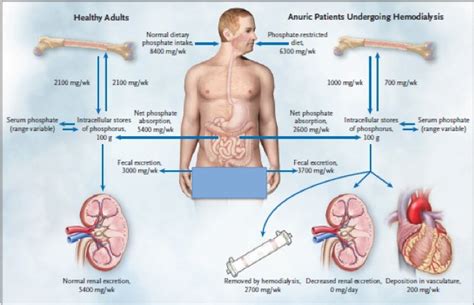 Pathophysiology Of Hyperphosphatemia Phosphate Control In Chronic
