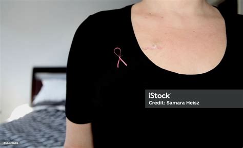 젊은 여자의 가슴 핑크 유 방 암 인식 리본 오프 쇼에 삽입 하는 포트와 클로즈업 화학 요법 치료제에 대한 스톡 사진 및 기타 이미지 화학 요법 치료제 암 암세포