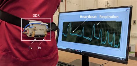 Wearable Near Field Radio Frequency Sensor For Cardio Pulmonary Monitoring RF Vital Sensing