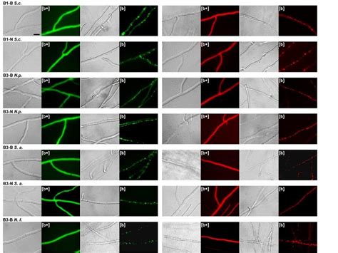 bass motif prion a formation in podospora anserina micrographs of p download scientific