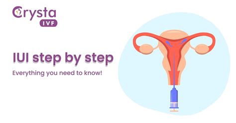 iui procedure step by step crysta ivf