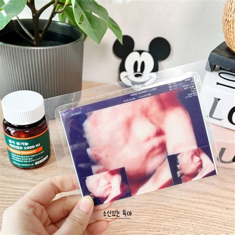 임신준비 영양제 똑똑하게 챙겨요 네이버 블로그