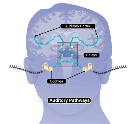 Primary Auditory Cortex