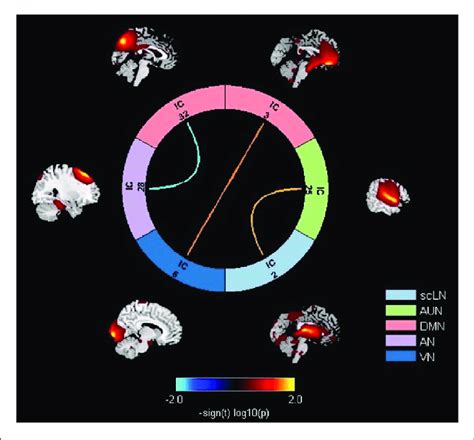 Significant Differences In The Network Connectivity In The Download Scientific Diagram