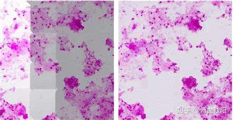 基于全卷积神经网络的显微图像光照不均校正 知乎