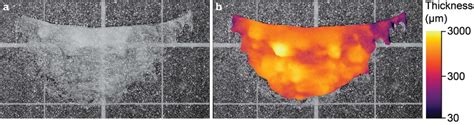 High Resolution Thickness Map Of An Anterior Mitral Valve Leaflet Via Download Scientific