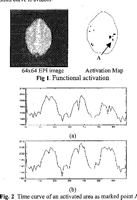 Figure 2 From Fft Based Subpixel Mri Image Registration And Its Application In Fmri Semantic