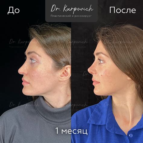 Цены на услуги Доктор Карпович пластический и ринохирург в Москве