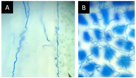 Understanding Endophytes The History And Morphology Of Endophytes And