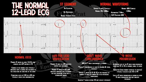Foamfrat The Normal 12 Lead Ecg