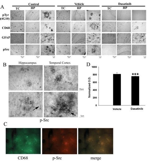 Dasatinib Infusion Attenuated Microgliosis Protein Phosphotyrosine And Download Scientific