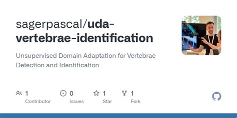 Github Sagerpascal Uda Vertebrae Identification Unsupervised Domain Adaptation For Vertebrae