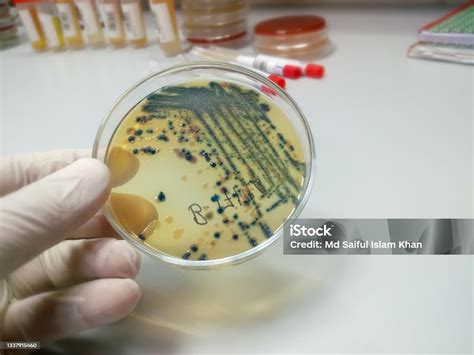 미생물학 실험실의 배경에 페트리 접시를 들고 기술자 또는 과학자의 장갑 손 세균 문화 배지 미생물 학자 박테리아 Stem 주제에 대한 스톡 사진 및 기타 이미지 Istock