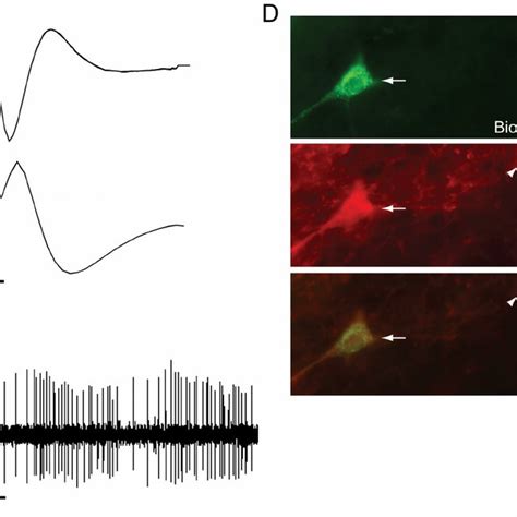 Mpfc Evoked Inhibitions In Dopamine Neurons Download Scientific Diagram