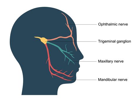 What Is Trigeminal Neuralgia Causes Symptoms And Precautions