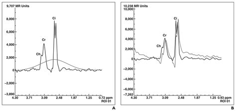 Adjustments To Spectra A Automated Baseline Correction Sinusoidal Download Scientific