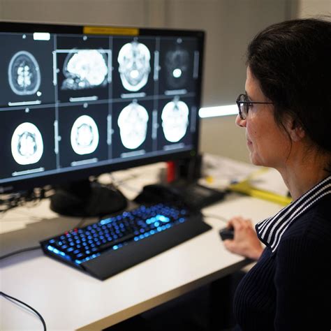 Ai Radiology Digitalmedicine Brain Diseases Multiplesclerosis Sydney Neuroimaging