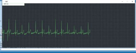 I Am Trying To Get A Smooth Ekg Output From My Ad8232 Paired With