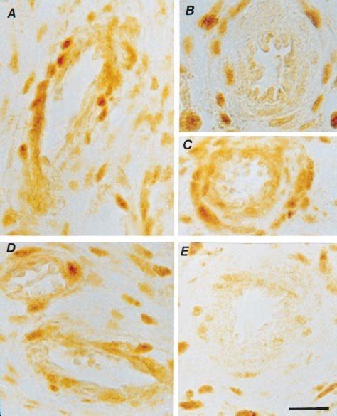 Immunohistochemical Localization Of Oestrogen Receptorsa C And