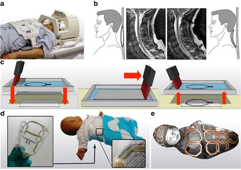 Rf Receive Coil Arrays Proximity To Body Results In Better Image Snr Download Scientific