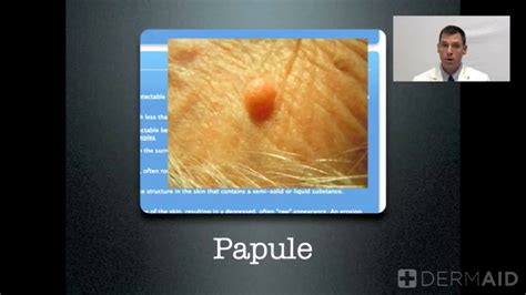 Dermatology Terms Youtube
