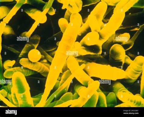 False Colour Scanning Electron Micrograph Sem Of A Culture Of The Dermatophyte Fungus