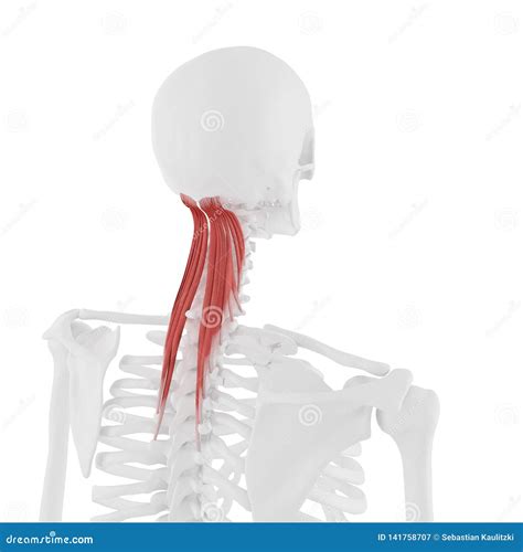 Semispinalis Capitis Trigger Points Can Cause Pain In The Back And Side