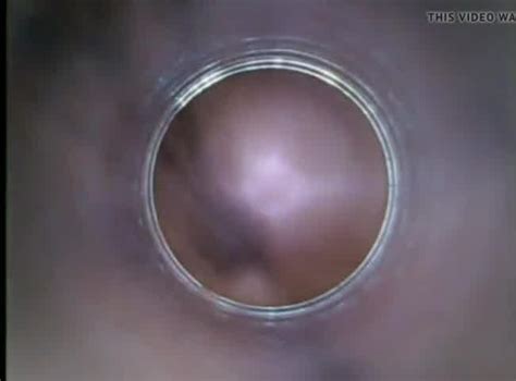 Vaginal Uterus And Intravaginal Ejaculation307 Pornography Six