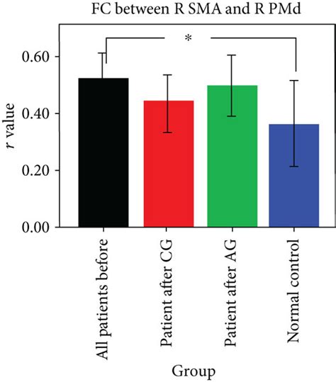 Functional Connectivity Comparison Between Groups Significant Download Scientific Diagram