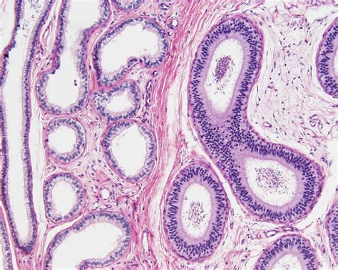 Efferent Ductules Histology