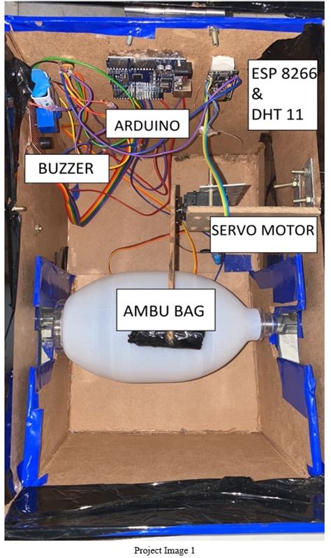 IoT Based Ventilator
