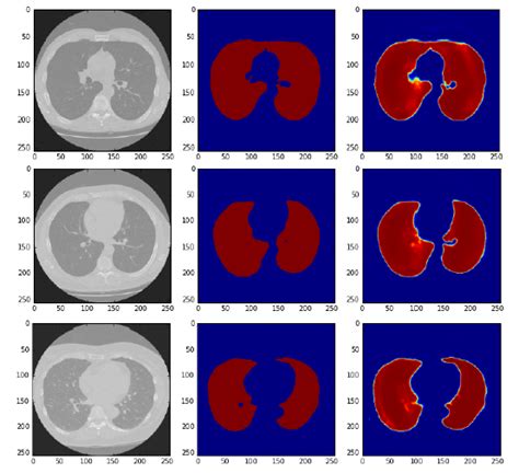 Review Ru Net And R2u Net — Recurrent Residual Convolutional Neural Network Medical Image