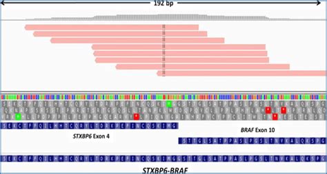 Using The Rna Seq Assay To Detect Gene Fusions Can Improve The Diagnosis And Targeted Treatment
