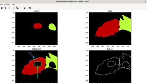 How Does Cellprofiler Define Edges For A Cytoplasm Mask Image Analysis Imagesc Forum