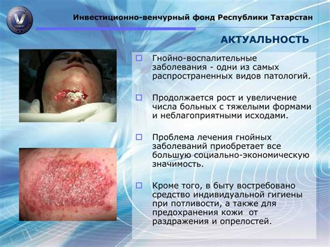 PPT - ПРЕЗЕНТАЦИЯ ПРОЕКТА «Организация производства медицинского ...
