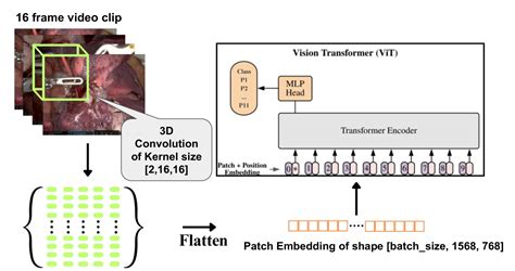 Must Multi Scale Transformers For Surgical Phase Recognition Ai Research Paper Details
