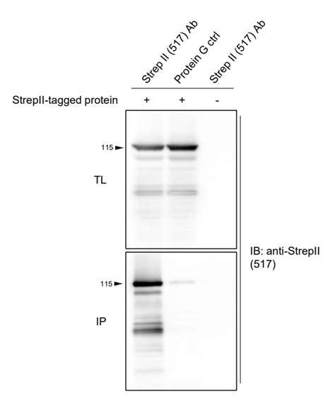 Strep Ii Tag Antibody 517 Azide And Bsa Free Nbp2 43735 Novus Biologicals