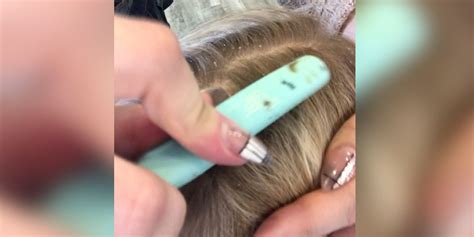 Scalp Exfoliation Is The Crucial Step Your Hair Care Routine Is Missing