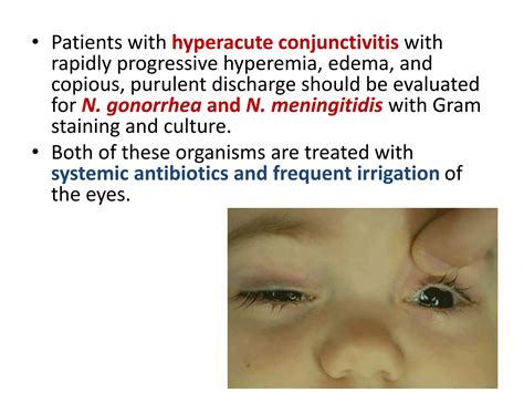 Diagnosis And Management Of Pediatric Conjunctivitis Pptx