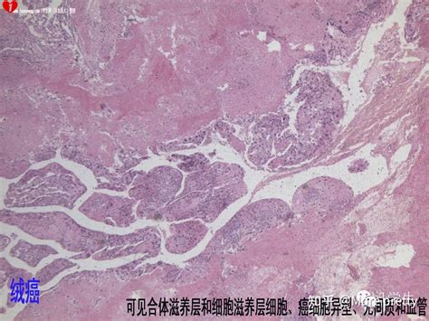 病理切片考试总结 知乎