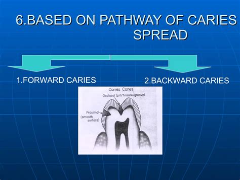 Classification Of Dental Caries Ppt