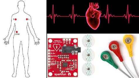 Ecg Monitoring System Ready Made Skynet Robotics