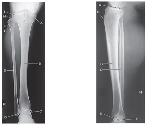AP Tib Fib Lateral Tib Fib Diagram Quizlet