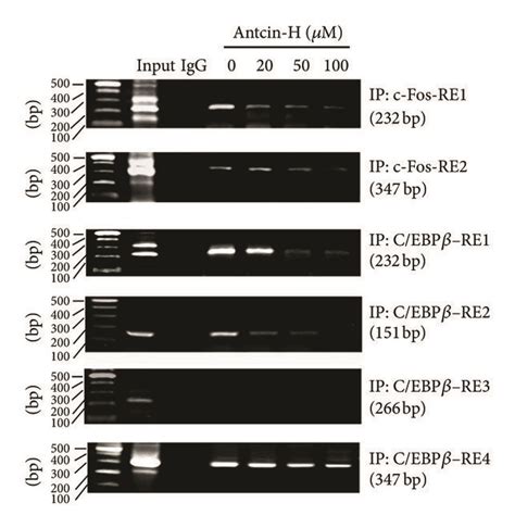 Inhibition of c Fos and C EBP β activities involved in Download Scientific Diagram