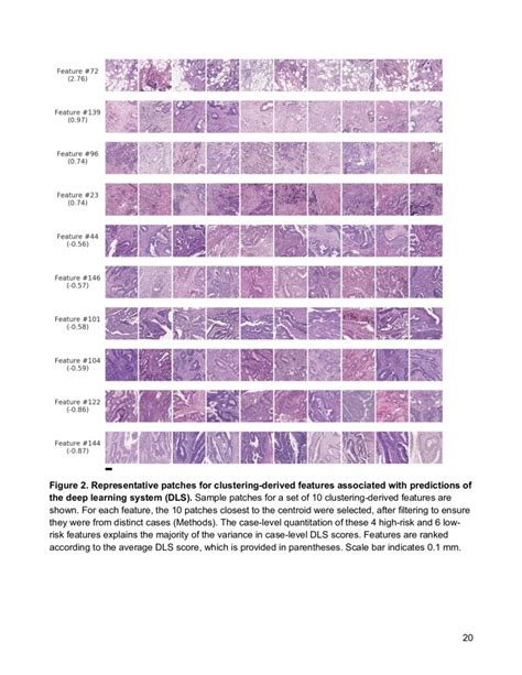 Interpretable Survival Prediction For Colorectal Cancer Using Deep Learning Deepai