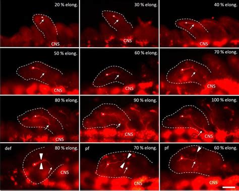 Exemplifications Of Axonal Growth And Guidance Defects Determination Download Scientific