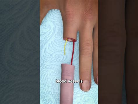 How To Reattach A Severed Finger Expert Precision For Restoration Eightify